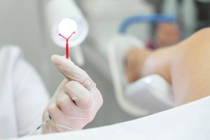 ¿Cómo funciona el DIU y cuáles son sus ventajas y desventajas ...